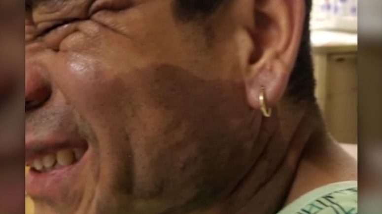 US citizen says he had acid thrown in his face after being told to go ...