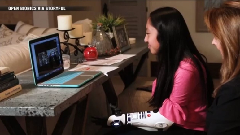 Young ‘Star Wars’ fan gets R2-D2 bionic arm; Mark Hamill calls her a ...