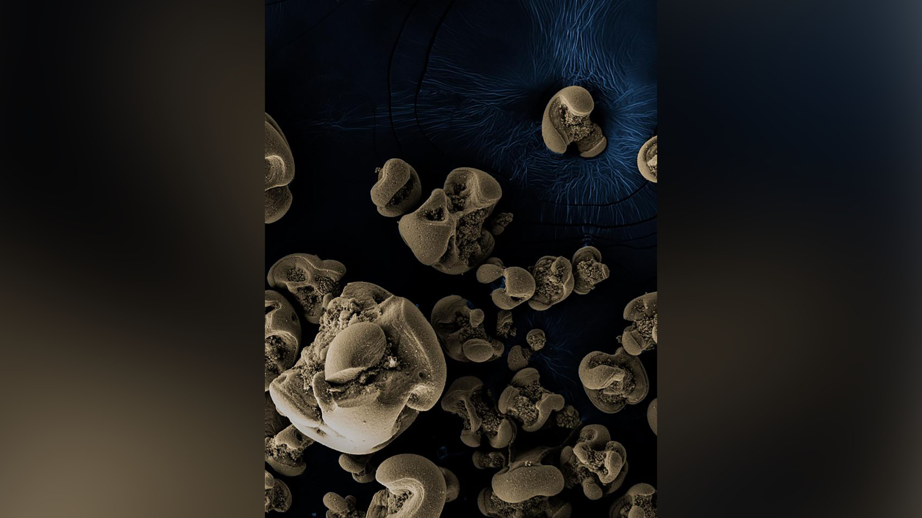 Bacteria that eats metal accidentally discovered by scientists - Boston ... Bacteria that eats metal accidentally discovered by scientists - Boston ...