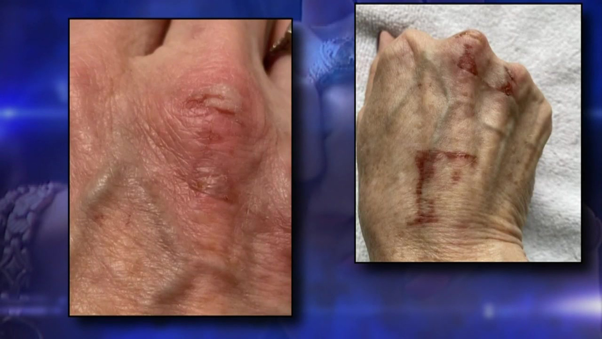 Solve It 7: Cosmetic Concerns - Boston News, Weather, Sports | WHDH 7News