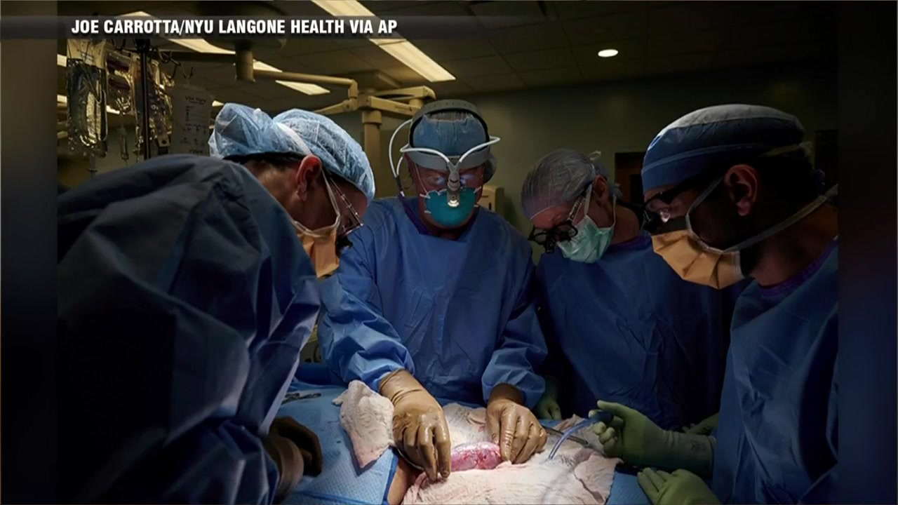 First person to receive a genetically modified pig kidney transplant ...