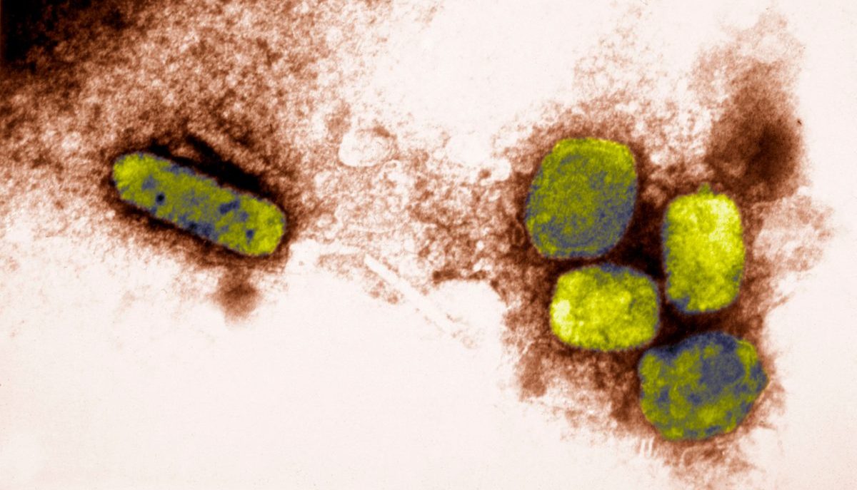 Vials labeled ‘smallpox’ found at vaccine research facility in ...