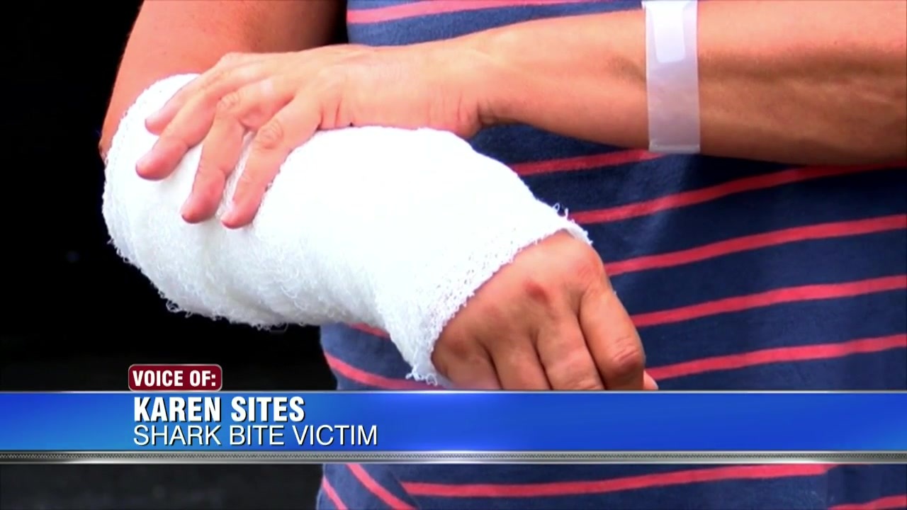 Woman attacked by shark on South Carolina beach - Boston News, Weather ...