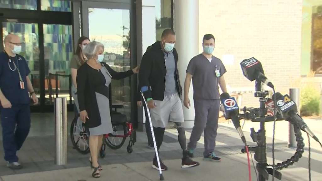 Man makes long strides in recovery after losing legs in building ...