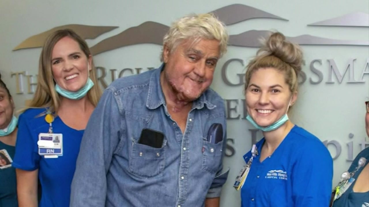 Jay Leno performing at California comedy club, two weeks after burn accident - Boston News ...