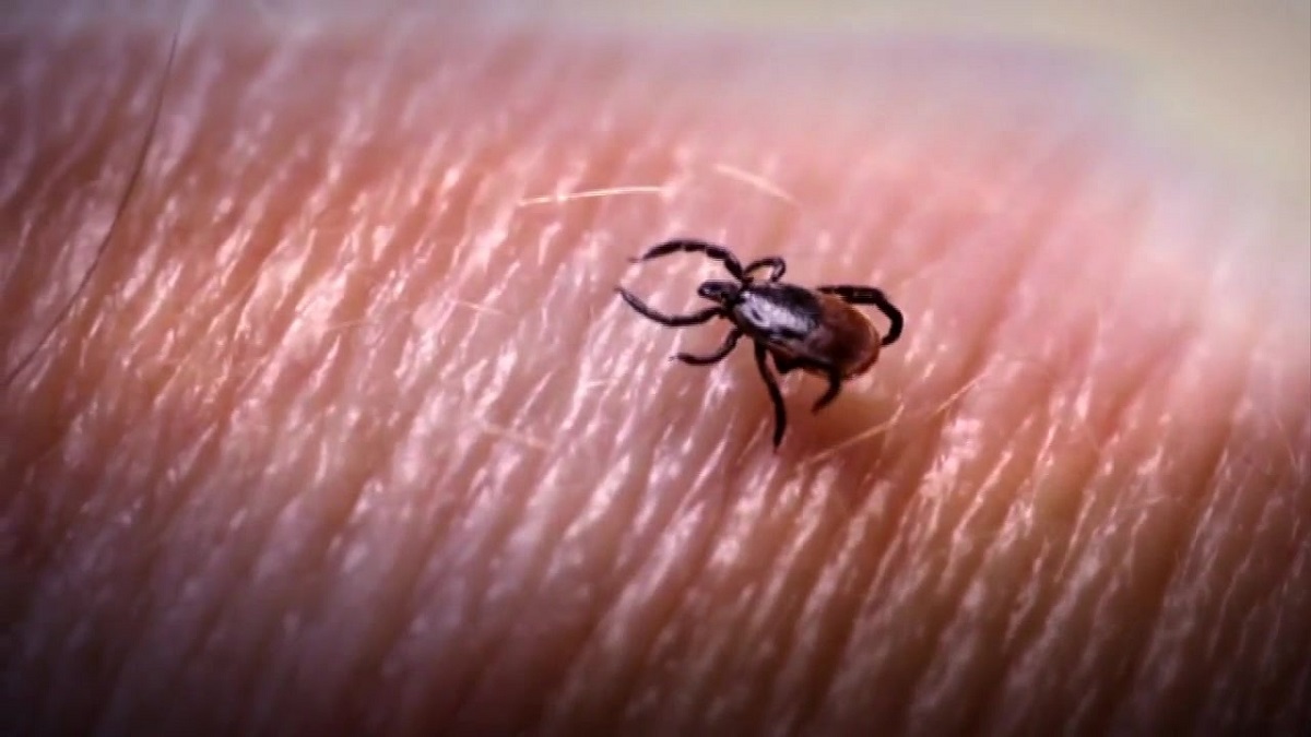 How to protect yourself from ticks year-round - Boston News, Weather ...