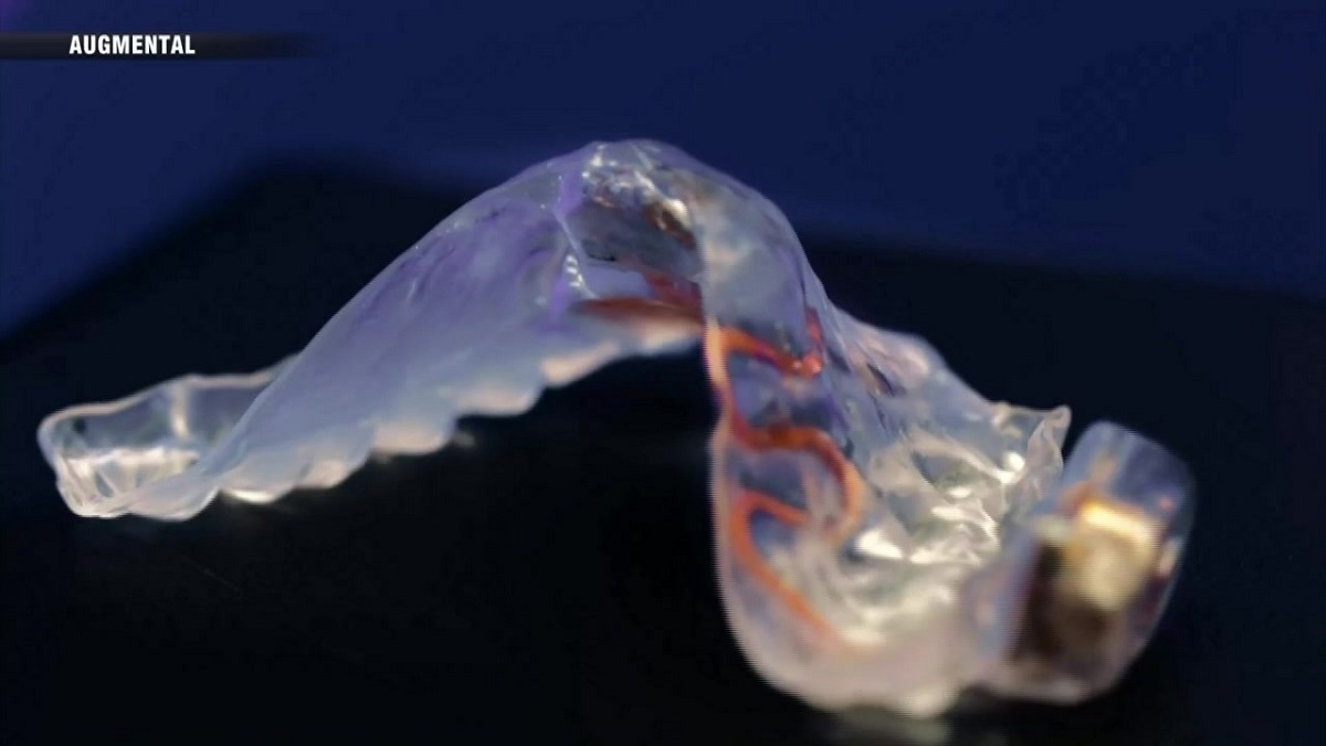 MIT graduate develops hands-free tongue-controlled computer interface ...