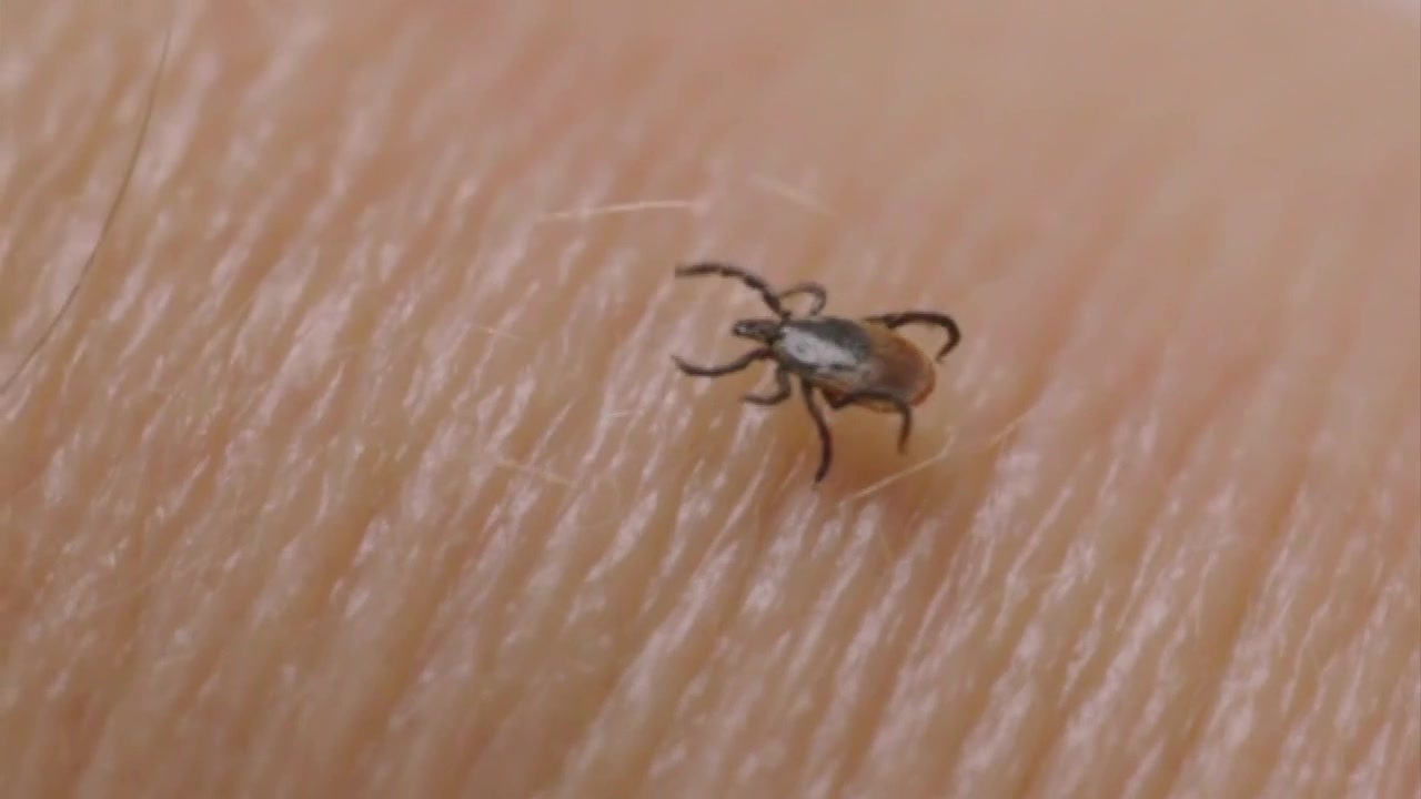 Tick Trouble: How to protect yourself this summer from Lyme disease ...