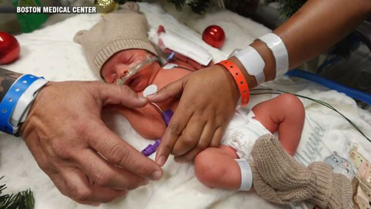 Babies at BMC’s NICU unit celebrate holidays early - Boston News ...