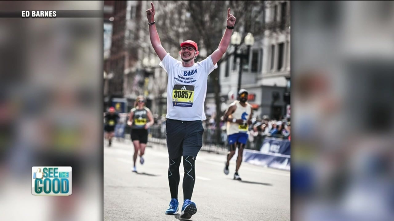 SEE THE GOOD: Douglas runner becomes first person with artificial heart ...